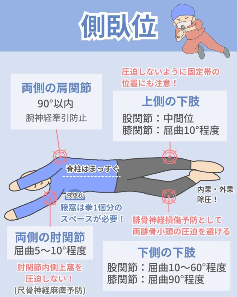【手術体位が及ぼす影響】手術の体位固定の観察ポイント【仰臥位・側臥位・腹臥位・砕石位・座位】 オペ看ノート 
